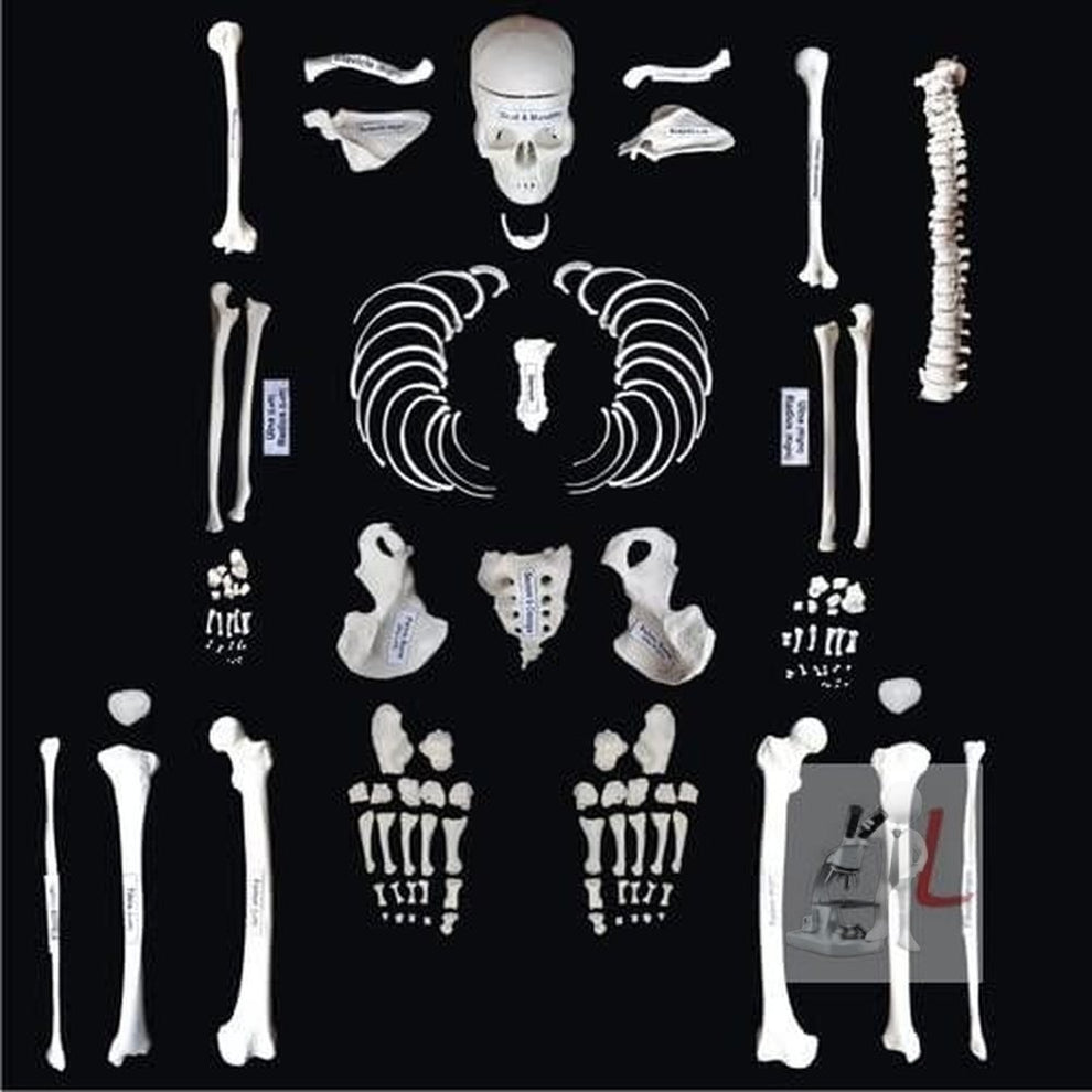 Disarticulated Skeleton Human (IMP.), Disarticulated Bone Set ...